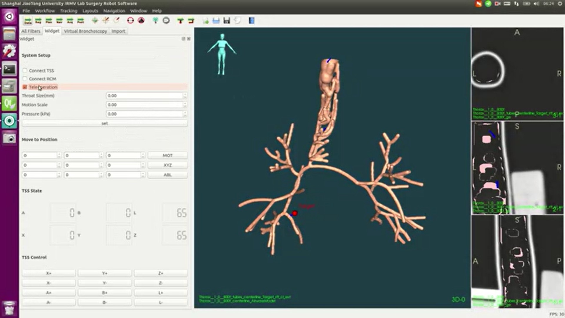 Image-Guided Surgery Software | Shu Gong